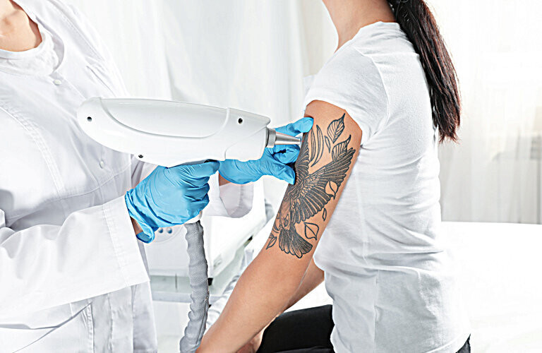 Tattoo Removal | Botox Fillers Sheffield £70