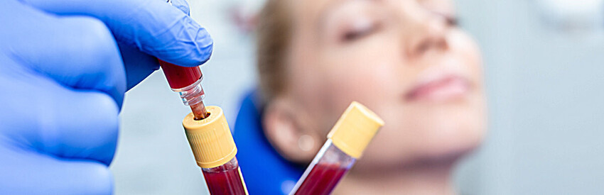 Vampire Lift Platelet Rich Therapy | Botox Fillers Sheffield £70