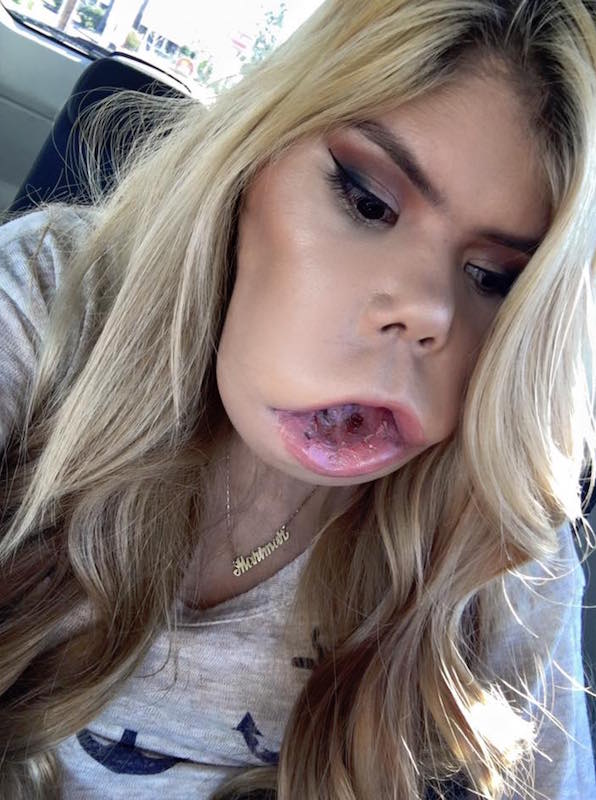 Marimar Quiroa, beauty guru con un tumore al viso