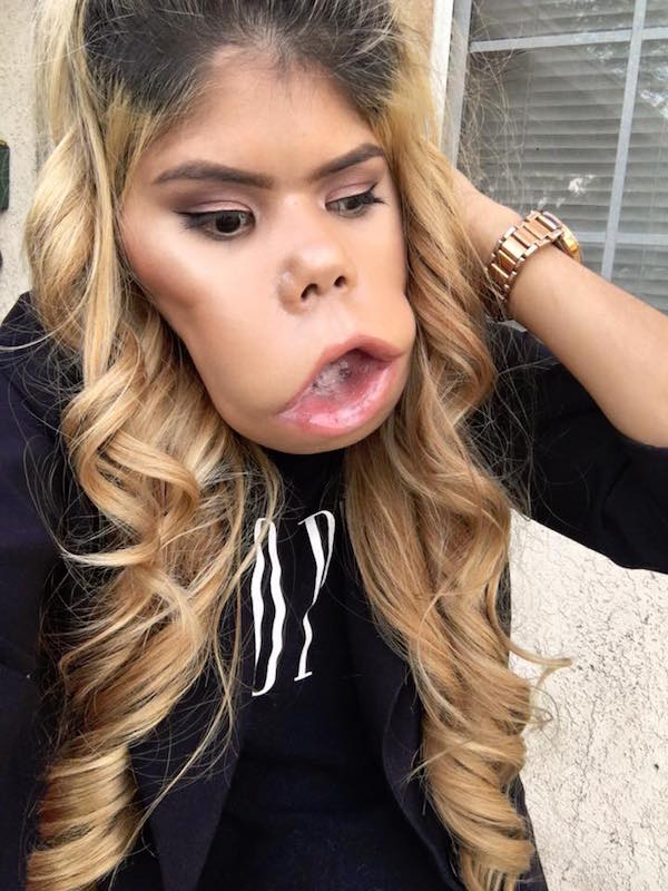 Marimar Quiroa, beauty guru con un tumore al viso