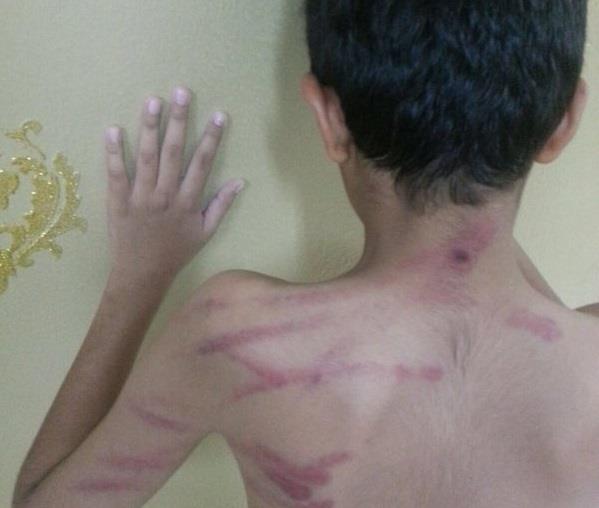 أخبار 24 بالصور معلم يعتدي بوحشية على طفل في المرحلة الابتدائية