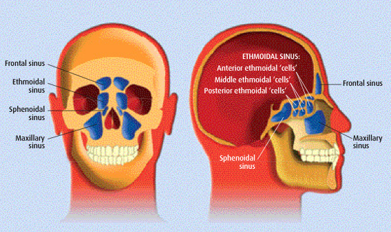 Sinusitis | Nursing Times