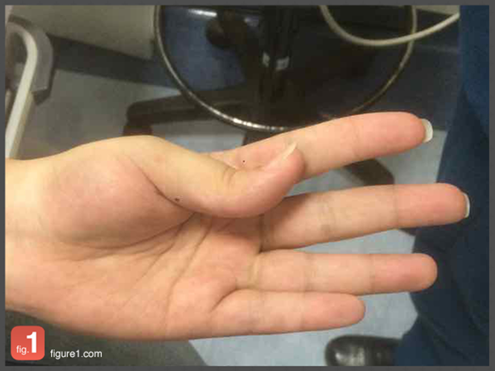 Do You Recognise This Post-Operative Complication? | Nursing Times