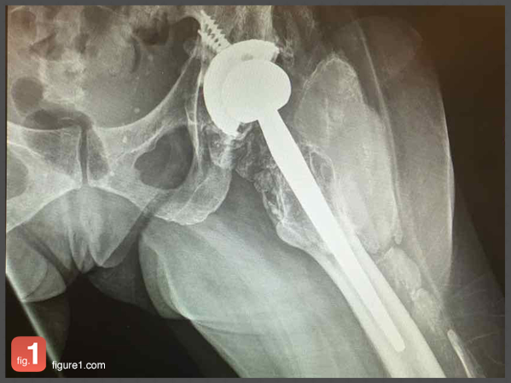 A life-threatening side effect | Nursing Times