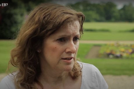 NHS 75: Making an impact – Jacqueline Denyer | Nursing Times