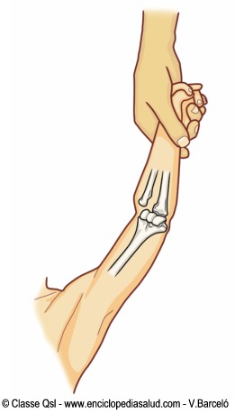 Enciclopedia Salud: Dislocación o luxación