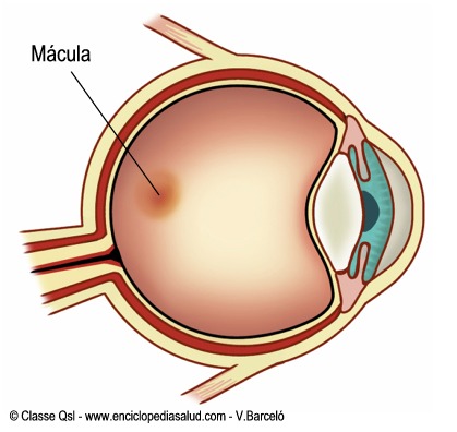 Enciclopedia Salud: Degeneración macular del ojo
