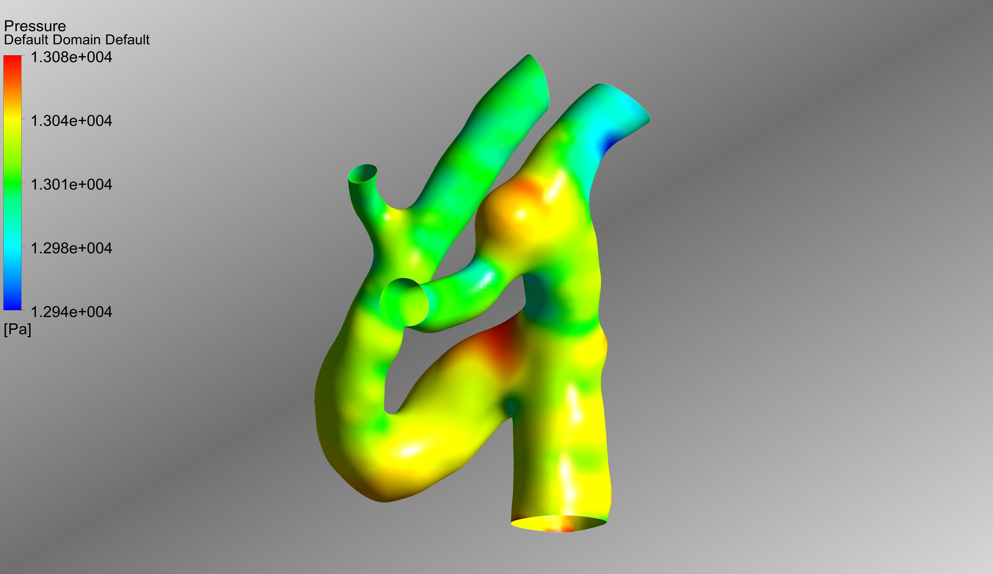 Computational Fluid Dynamics Of Aneurysm Cfd Simulations Fetchcfd