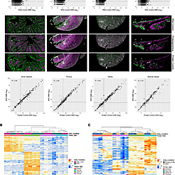 FIGURE 4 from Ultra High-plex Spatial Proteogenomic Investigation of ...