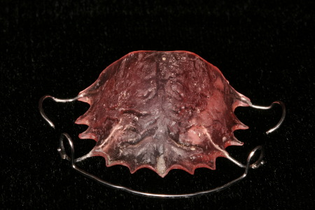 RETENEDOR TIPO HAWLEY by lineth - Infogram