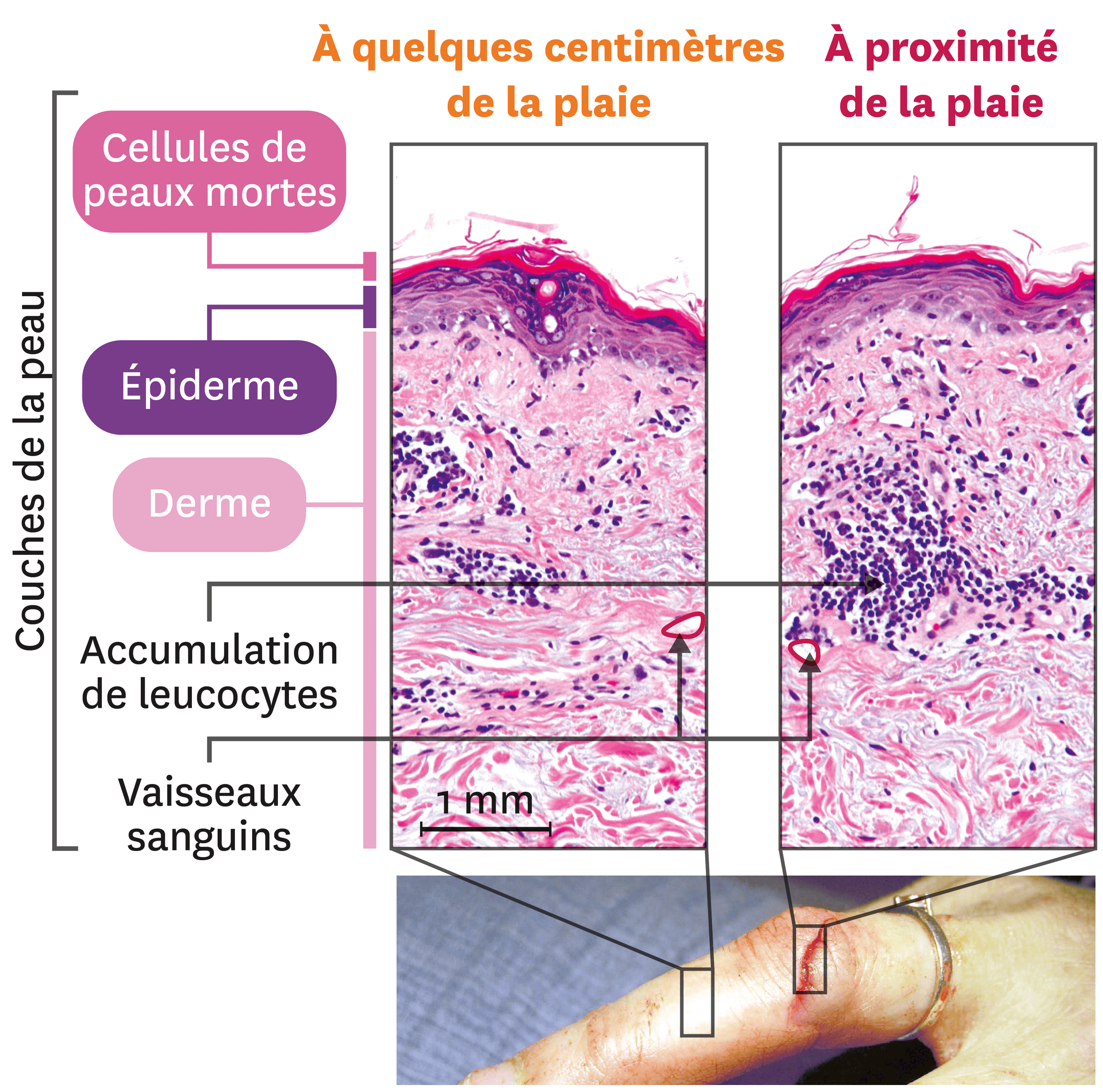 Deux coupes de peau humaine observées au microscope optique.