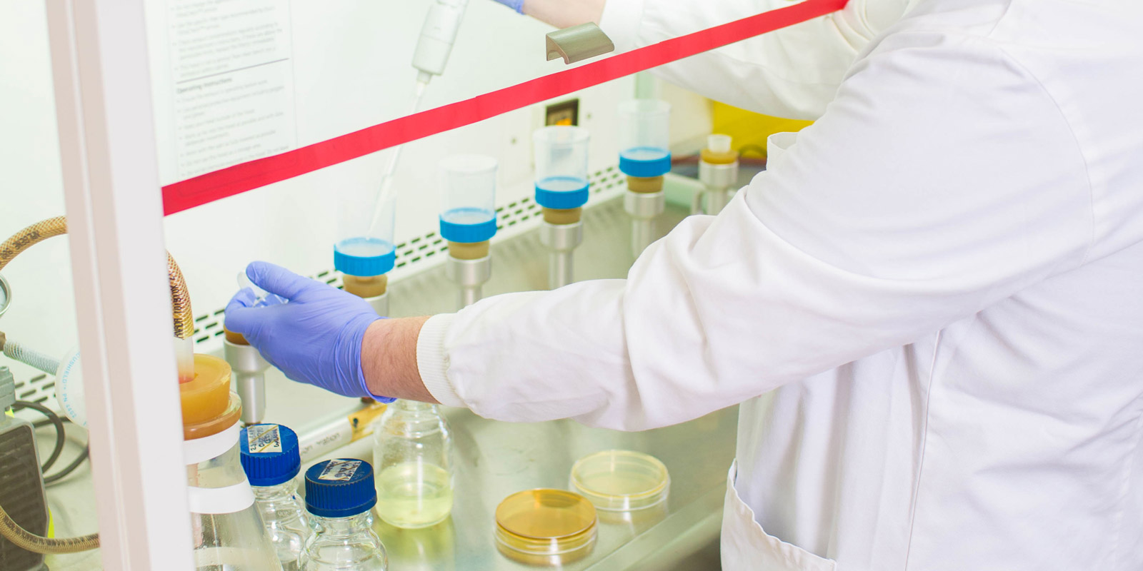 Microbiological Contamination Knowledge Hub | ECHA Microbiology