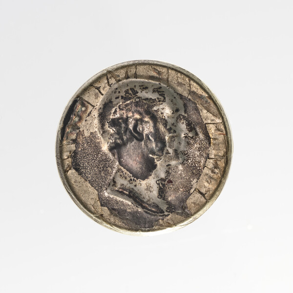 Robert Liston, 1794 - 1847. Surgeon by Leonard Charles Wyon | National ...