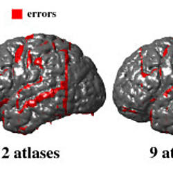Mindboggle: Automated brain labeling with multiple atlases-5