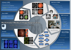 Multimodal Medical Image Registration