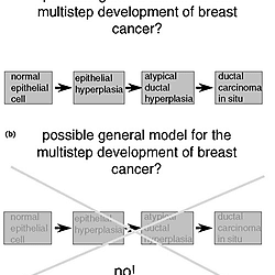 The multistep development of invasive breast cancer