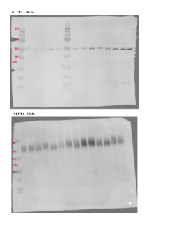 Supplemental Figure_JCEM_Insulin stimulates GLUT4 trafficking to the ...