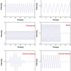 Standard waveforms of 6 respiratory patterns