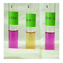 Urease test broth 24 hours after inoculation with strains
