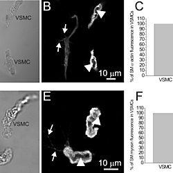 Fluorescent staining for SMA and SM-MHC