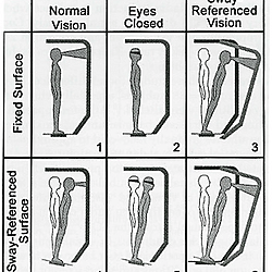 Sensory Organization Test (SOT)-Six Conditions