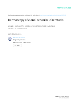 Dermoscopy of clonal seborrheic keratosis
