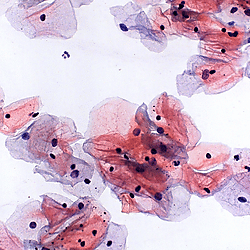 CRIC Cervix Microscope Slide Image #155