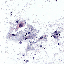 CRIC Cervix Microscope Slide Image #169