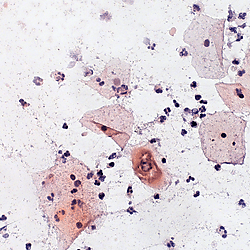 CRIC Cervix Microscope Slide Image #196