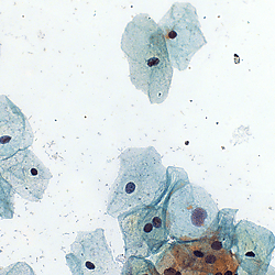 CRIC Cervix Microscope Slide Image #262