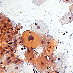 CRIC Cervix Microscope Slide Image #277