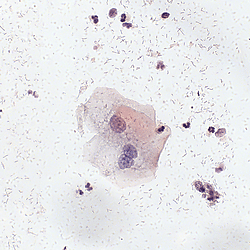 CRIC Cervix Microscope Slide Image #317