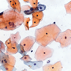 CRIC Cervix Microscope Slide Image #328