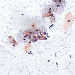 CRIC Cervix Microscope Slide Image #342