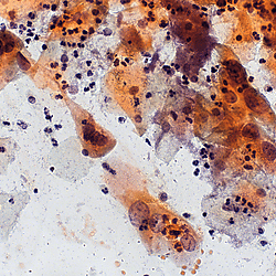 CRIC Cervix Microscope Slide Image #360