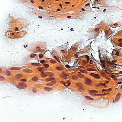 CRIC Cervix Microscope Slide Image #361