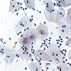 CRIC Cervix Microscope Slide Image #373
