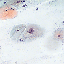 CRIC Cervix Microscope Slide Image #376