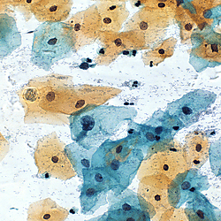 CRIC Cervix Microscope Slide Image #378