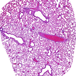 Figure 5 Histopath slides