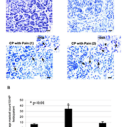 A Histology of autopsy specimen
