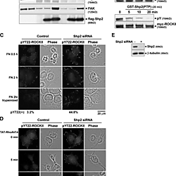 (A) In vitro substrate trapping assay