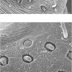 Detail view of the different sensilla types