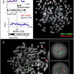 FISH mapping of Philadelphia negative positive CML-1