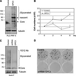Role of GPC3 in HCC cell oncogenecity