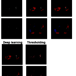 Segmentation using different methods