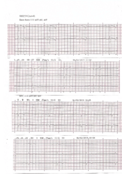 ECG raw.pdf