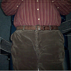 This picture shows the placement of the pelvic blocks for an anterior ...