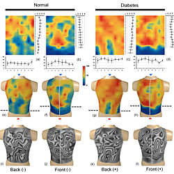 The average 2D-3D topographic map of the torso electrical activity