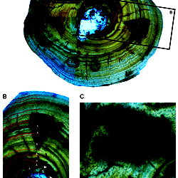 Paleohistology of Susisuchus anatoceps